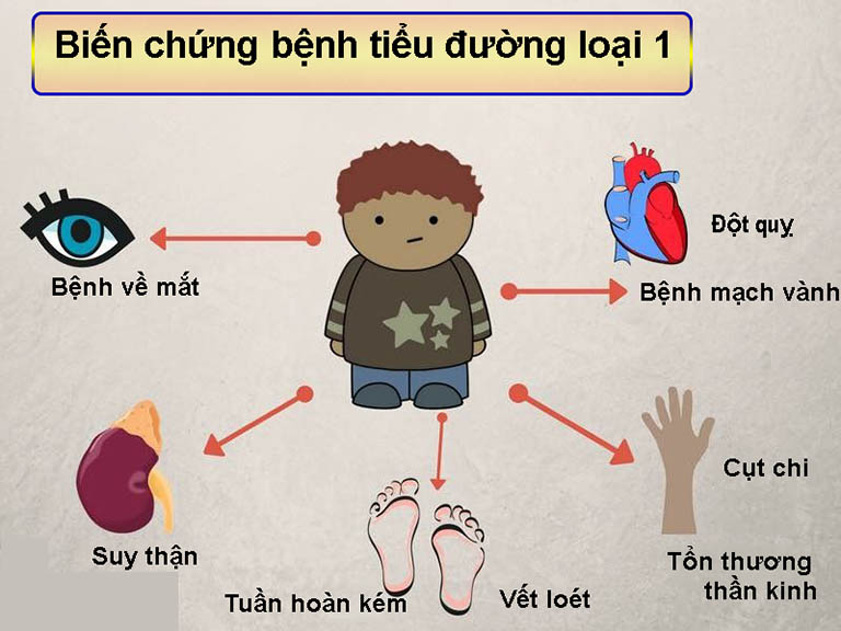 Tiểu đường type 1 là gì? Nguyên nhân, dấu hiệu và cách trị bệnh hiệu quả